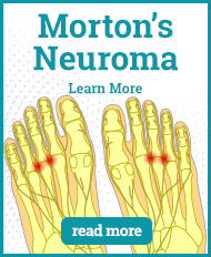 Insoles for Morton's Neuroma - ShoeInsoles.co.uk