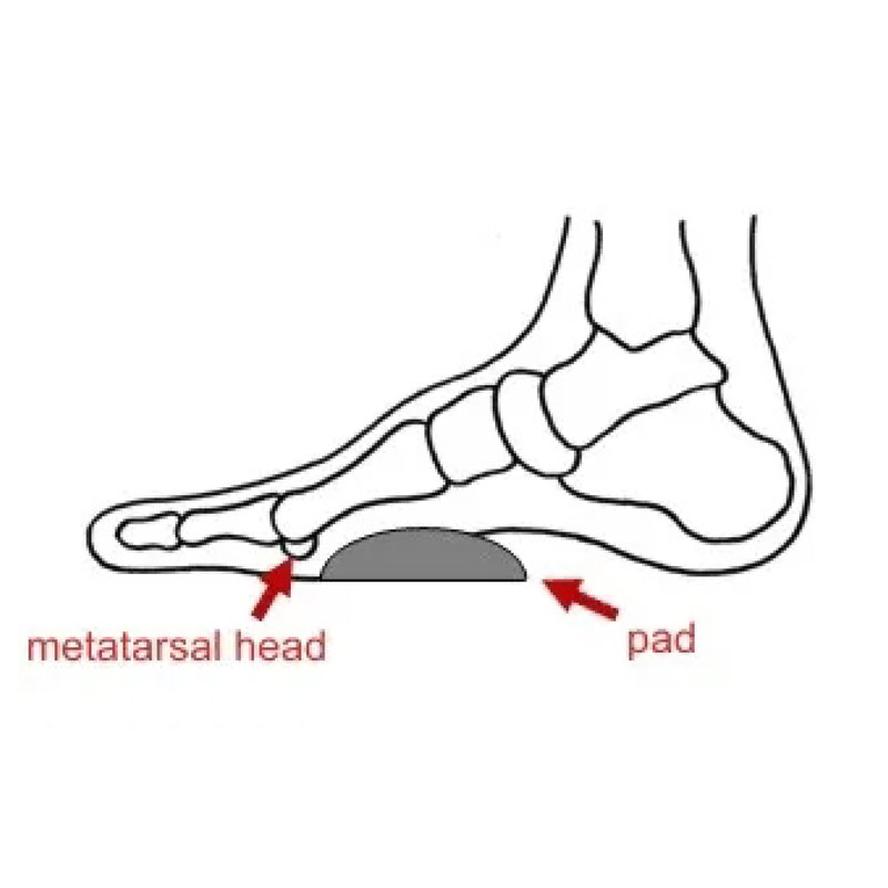 Metatarsal Domes - ShoeInsoles.co.uk