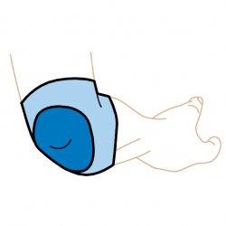 Silipos Gel Heel/Elbow Slip-Over Sleeve - ShoeInsoles.co.uk